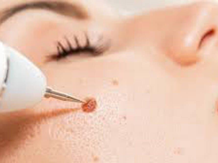 Best Skin Specialist in Bhiwadi, Best Dermatologist in Bhiwadi